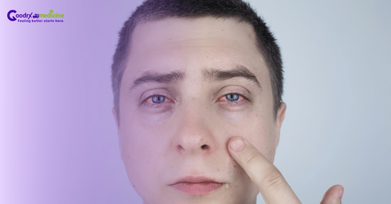 Amoxicillin for Pink Eyes: Effective Treatment Guide