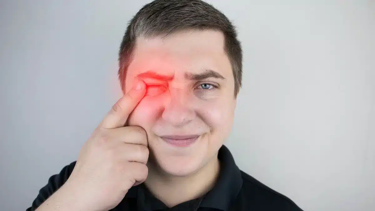 Know What Foods to Avoid With Uveitis