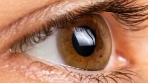 Marginal Keratitis: Symptoms, Causes, and Treatment Options