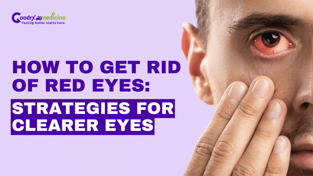 How to Get Rid of Red Eyes: Effective Solutions