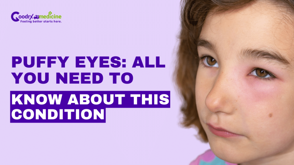 Puffy Eyes Explained: Causes, Solutions, and More